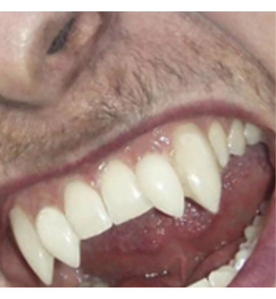 Scarecrow Crocs de loup-garou Deluxe, sur mesure | DeinDeal