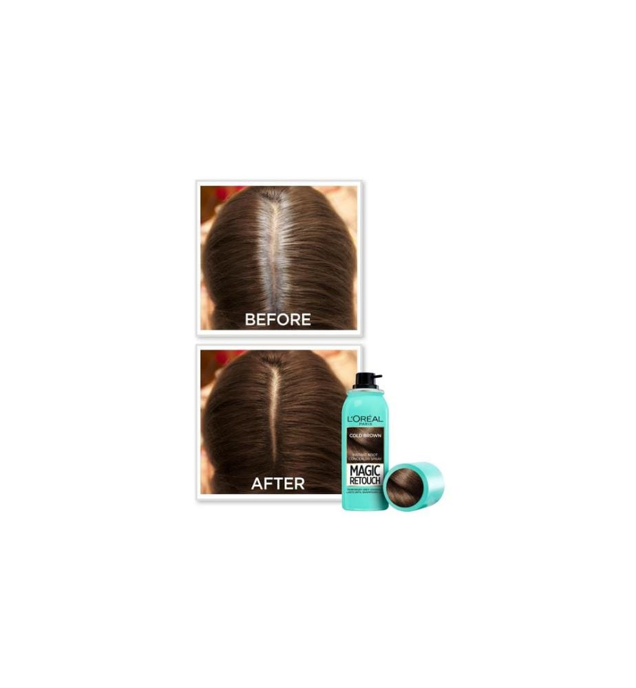 L'Oréal Paris - Haaransatz-Spray Magic Retouch K… | DeinDeal
